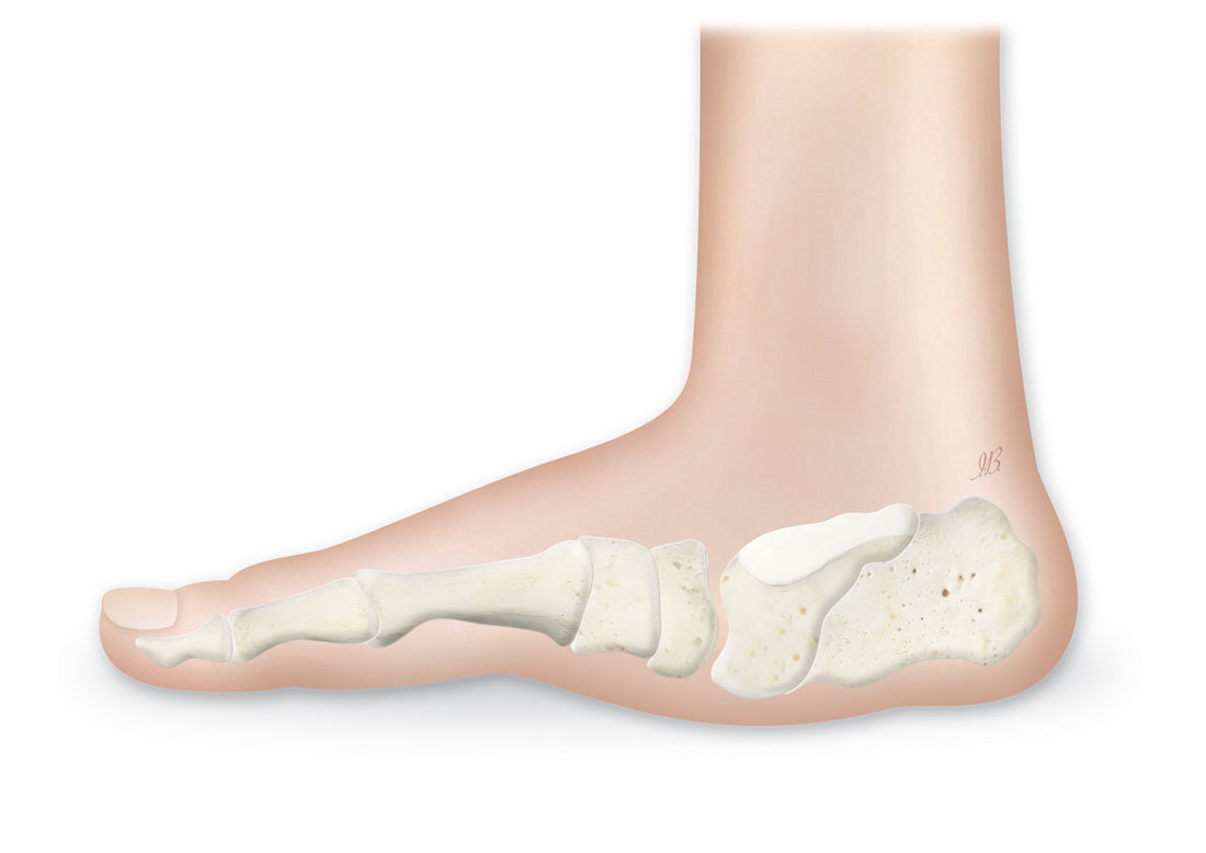 Understanding Charcot Foot: Causes, Symptoms, and Treatments – Daphco ...