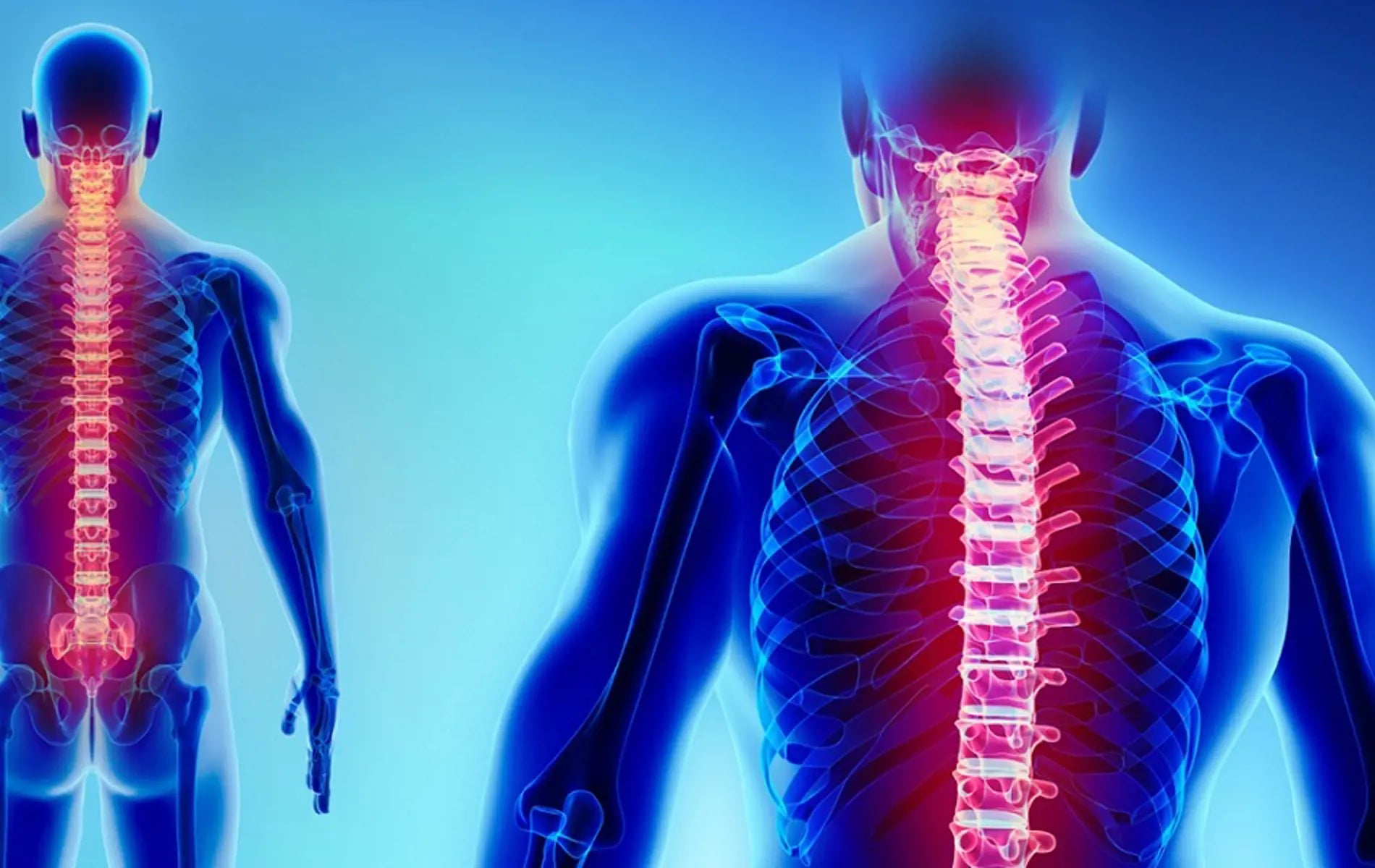 Spinal Cord Compression: Symptoms, Treatment, and Diagnosis – Daphco ...